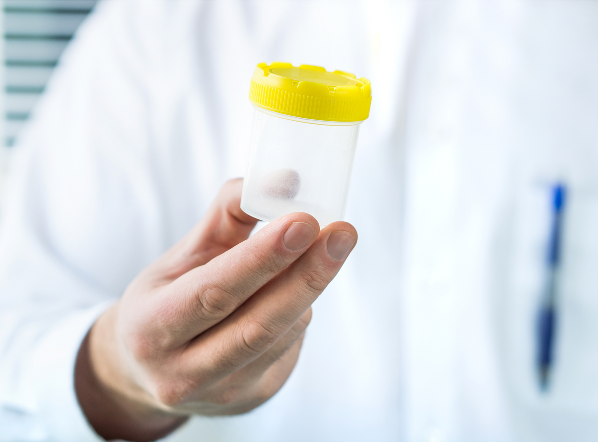 Prevent Nucleic Acid Degradation Before Extraction