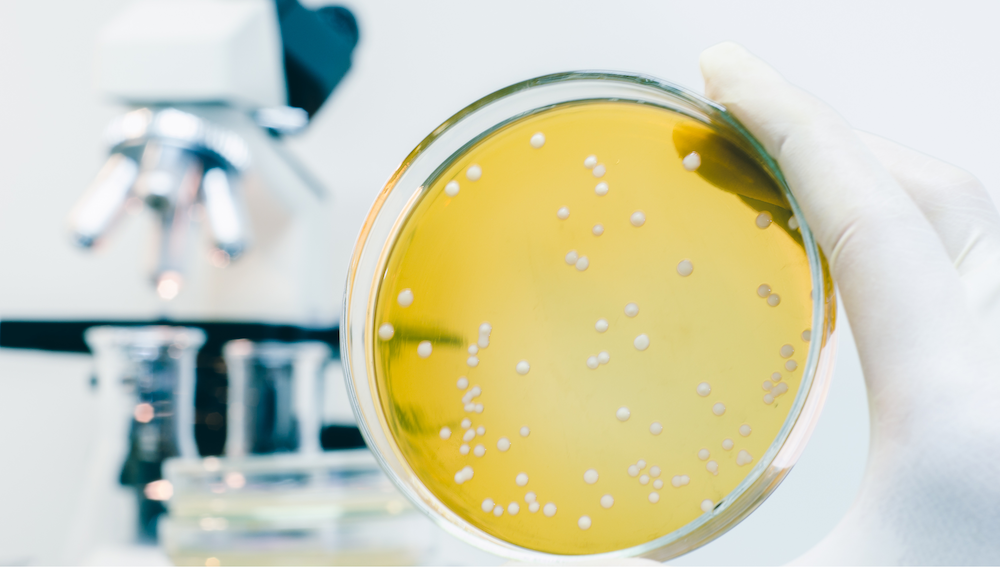 How to Make Competent Cells: Protocols and Tips | ZYMO RESEARCH