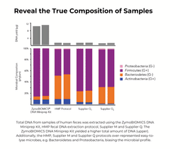 ZymoBIOMICS DNA Miniprep Kit - Microbial DNA Extraction